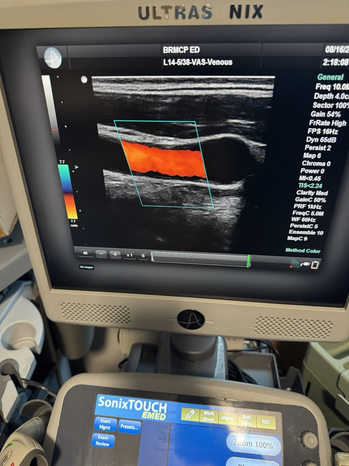 UltraSonix Sonix Touch Ultrasound Machine With 2 Transducer Probes ...