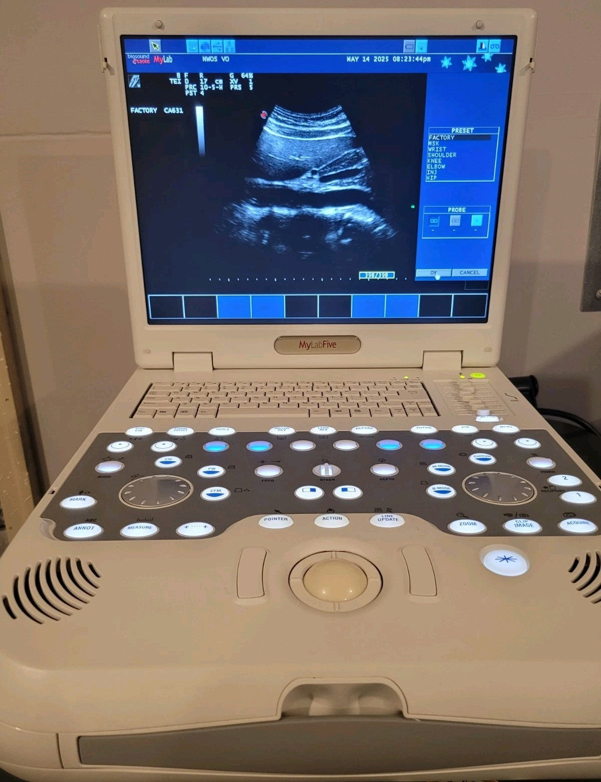 esaote MyLabFive Ultrasound Machine MyLab 5 With Linear Transducer Pro ...